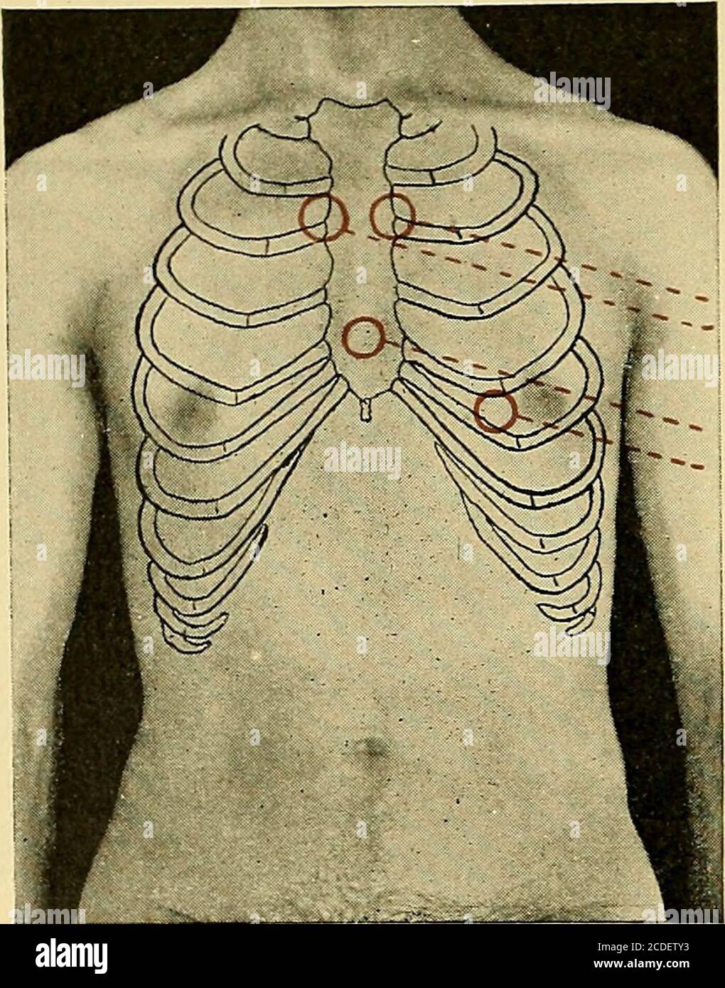 Sternal cartilage hi-res stock photography and images - Alamy