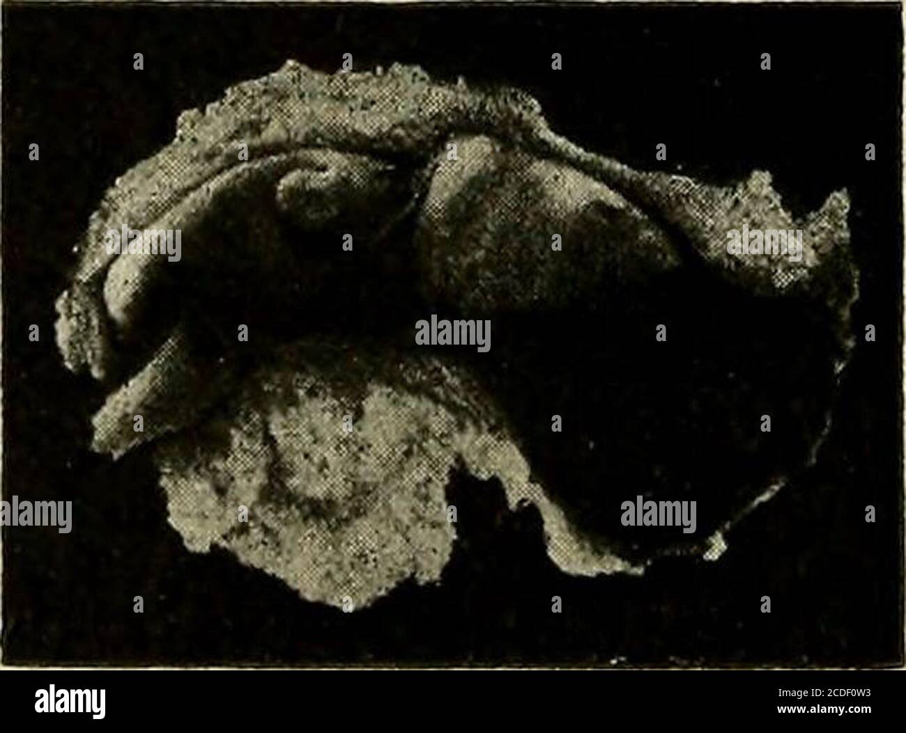 Human embryo tail hi-res stock photography and images - Alamy