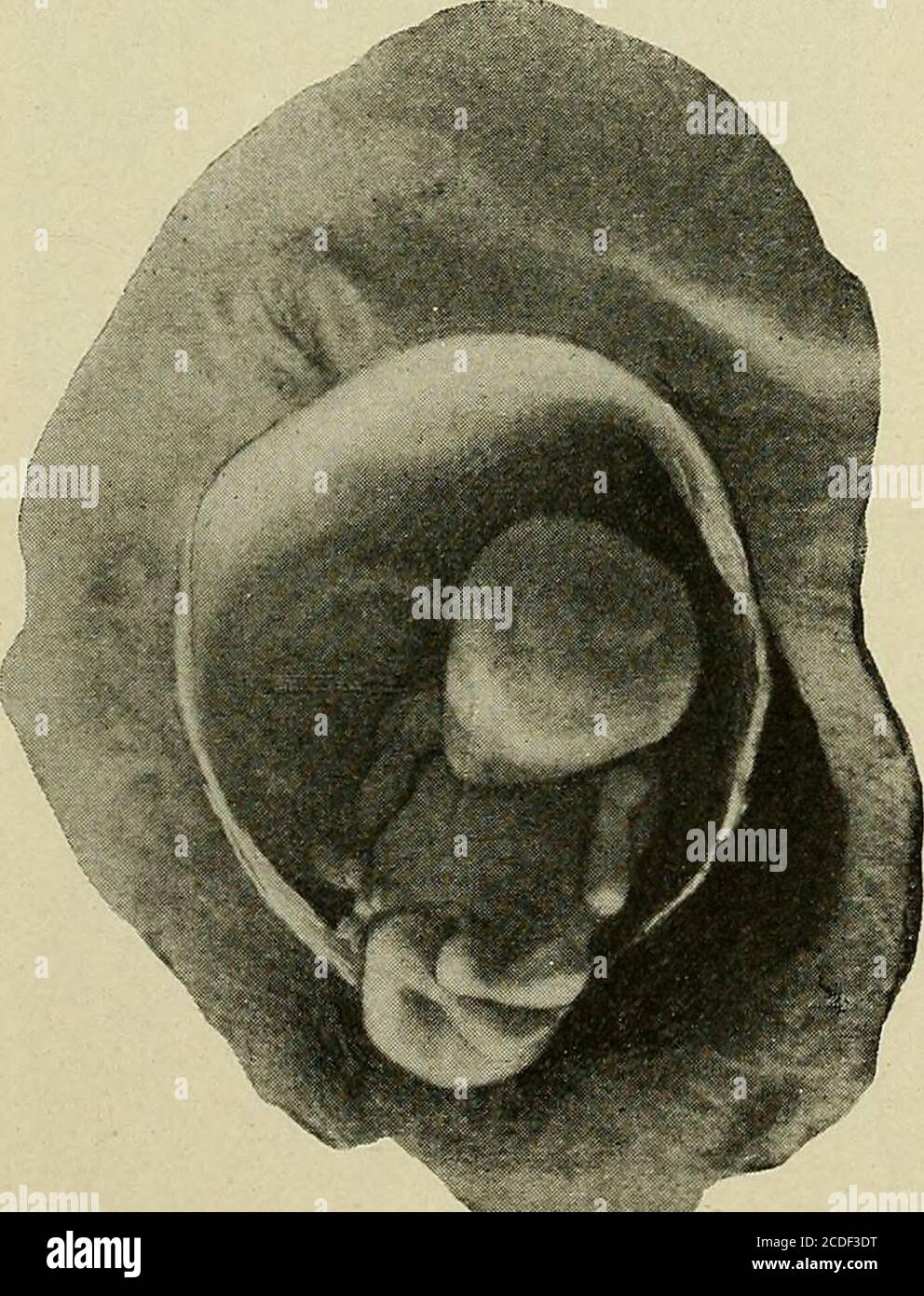. A study of the causes underlying the origin of human monsters : third ...