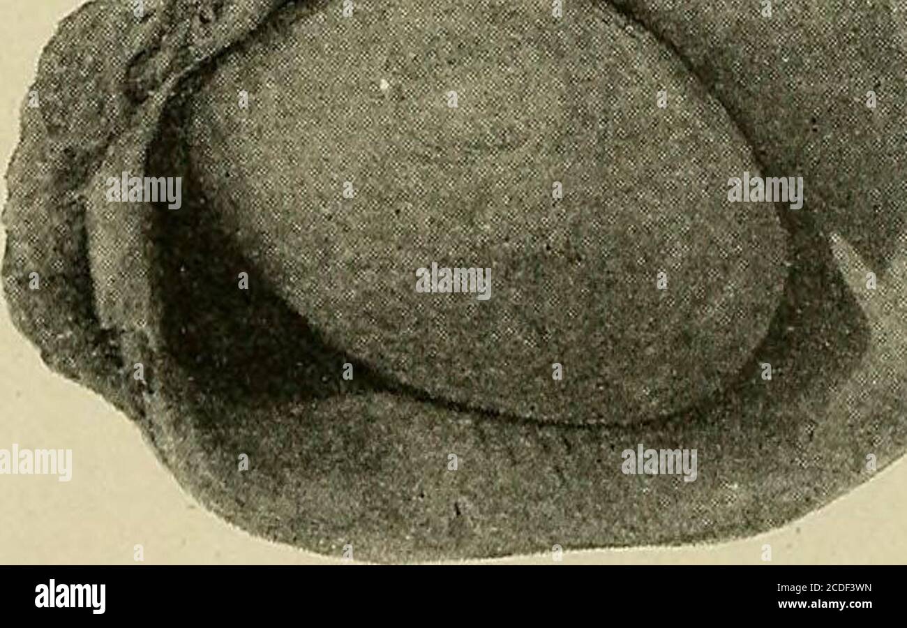 . A study of the causes underlying the origin of human monsters : third ...