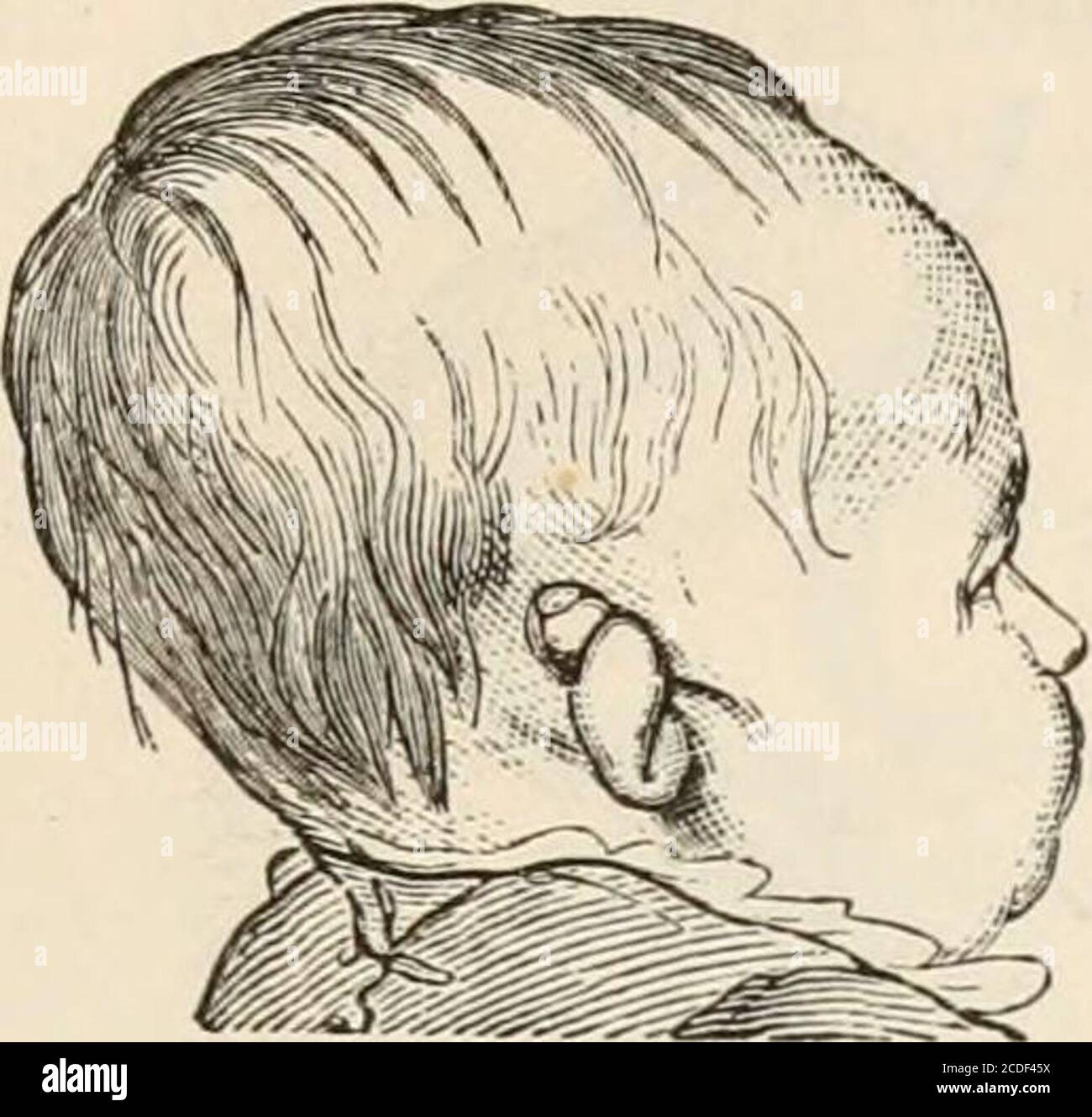 Deep fissured hi-res stock photography and images - Alamy