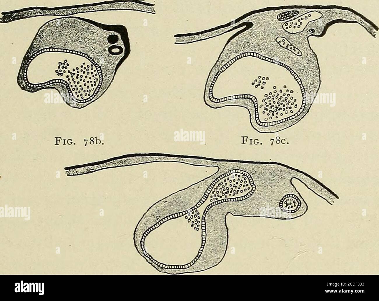 Double placenta hi-res stock photography and images - Alamy