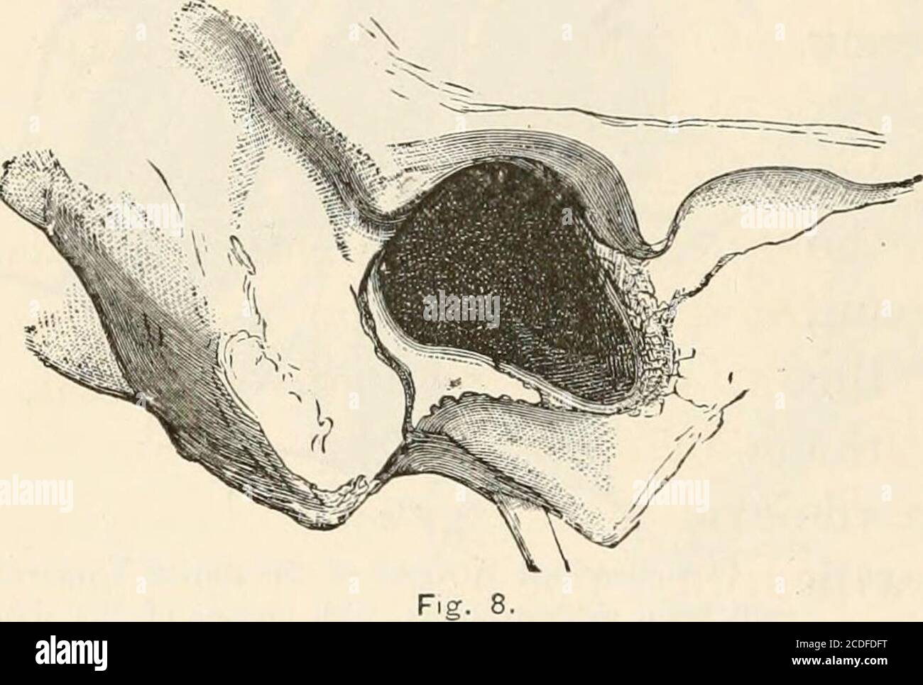Connective tissue capsule hi-res stock photography and images - Alamy