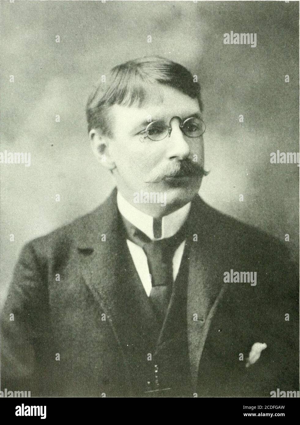 Joseph Merrick High Resolution Stock Photography and Images - Alamy