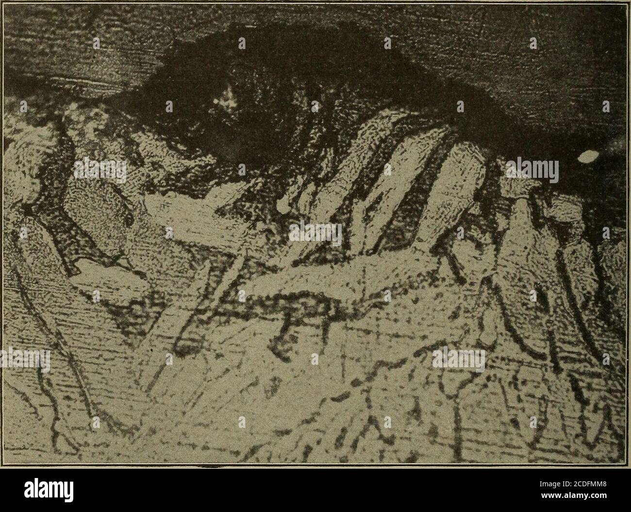 . Typical cases of the deterioration of muntz metal (60:40 brass) by ...