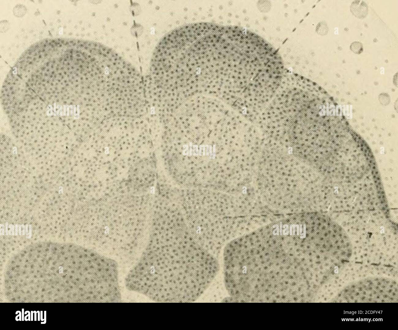 Growth plate fusion hi-res stock photography and images - Alamy