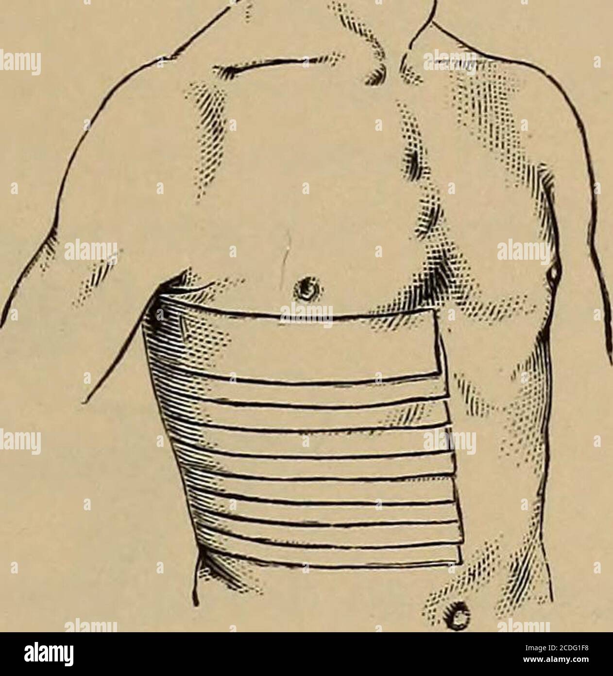 . Minor surgery and bandaging, including the treatment of fractures and ...