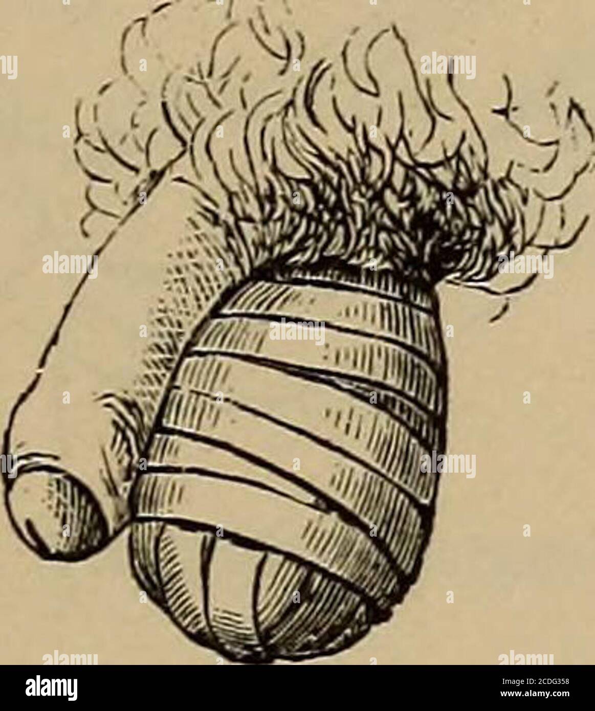 . Minor surgery and bandaging, including the treatment of fractures and ...