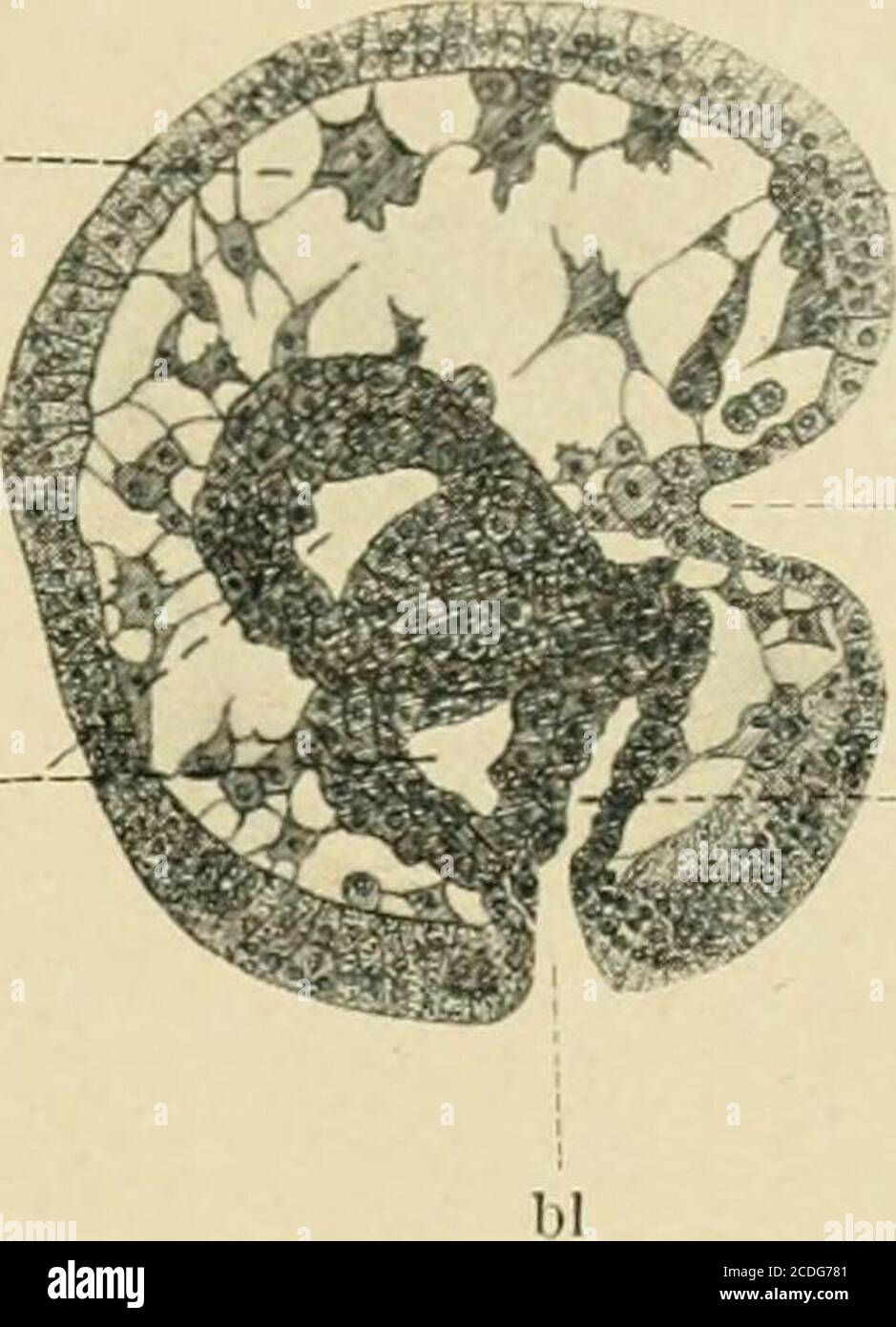 Vpv hi-res stock photography and images - Alamy