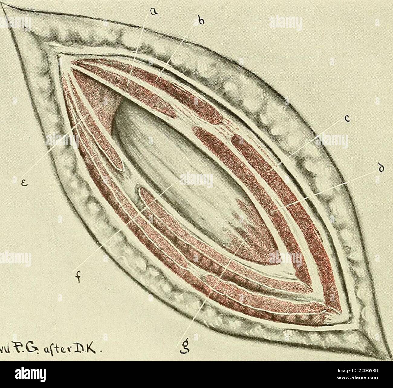 . Gynecology : . Fig. 406—Kellys Feting Pax Incision for >. ephkectomt ...