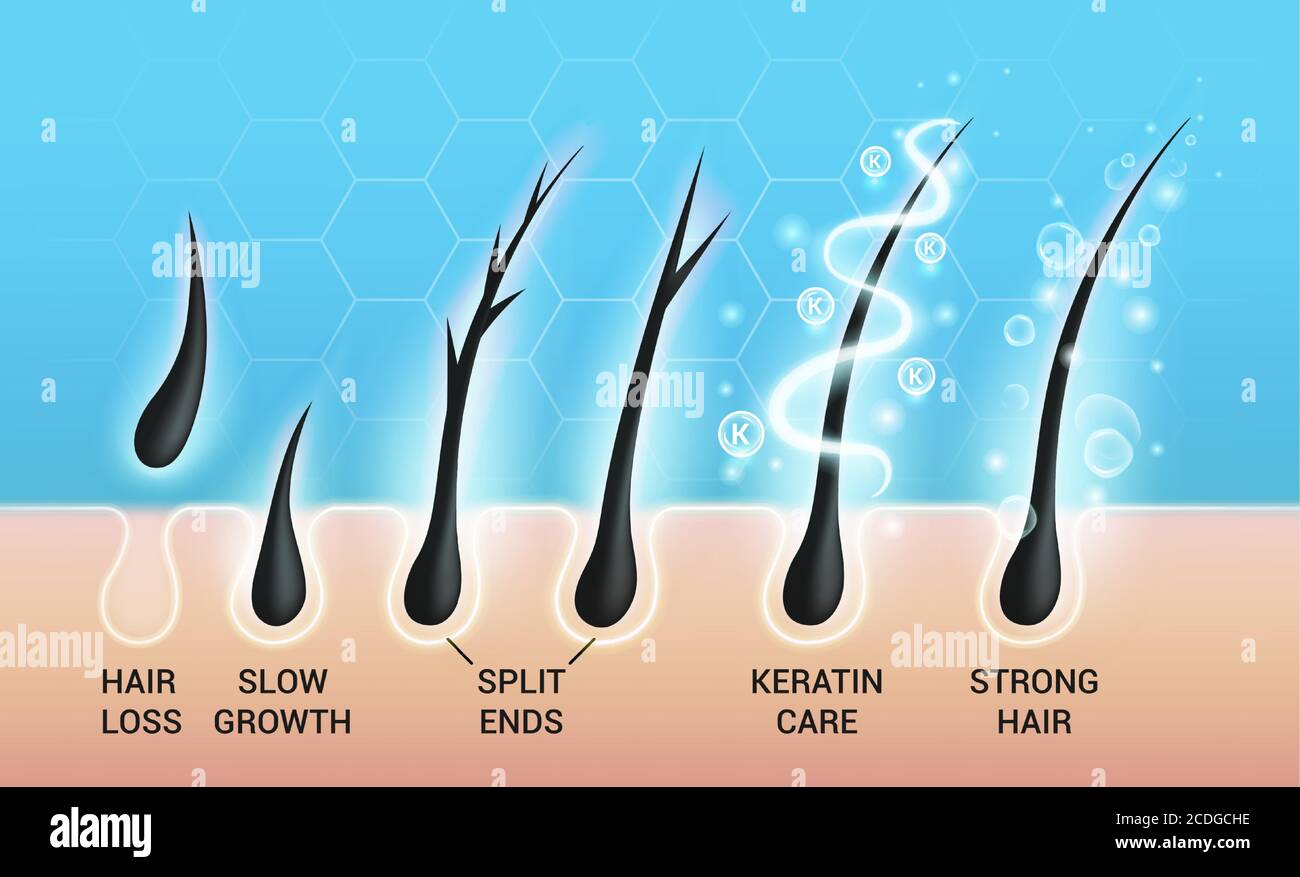 Split Ends Microscope Split Ends Microscope