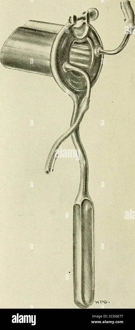 . Gynecology : . Vvl/p. fete Fig. 449.—Percy Cautery with Some of ...
