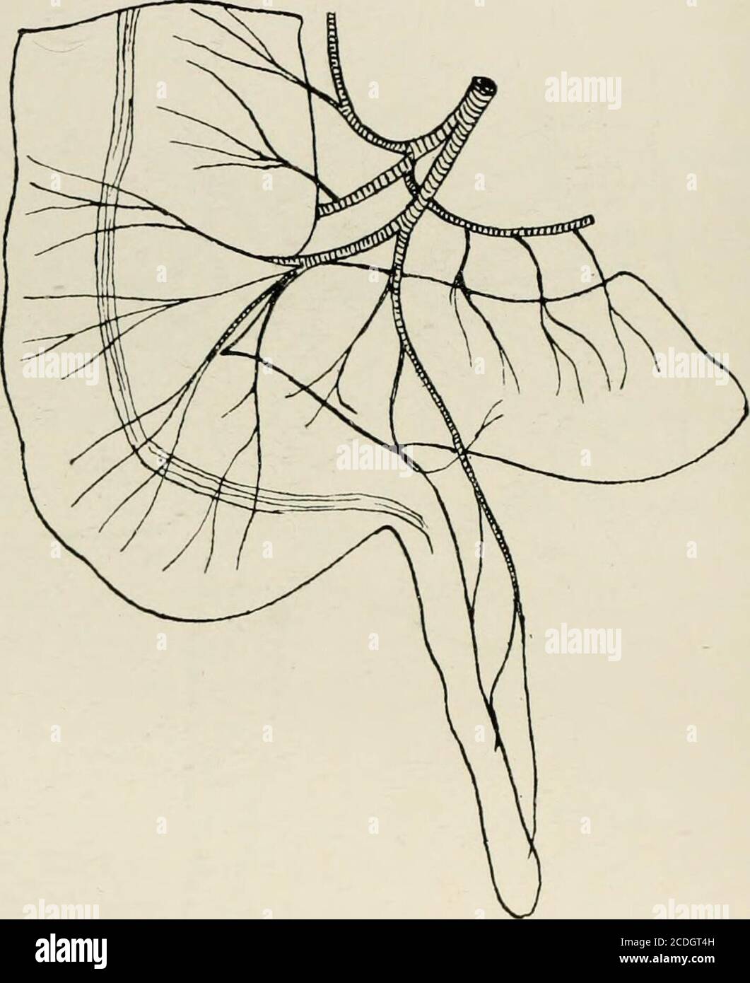 . On retro-peritoneal hernia . FjG. 23 DlAC.RAM OK THK Il.HO-CoLIC ...