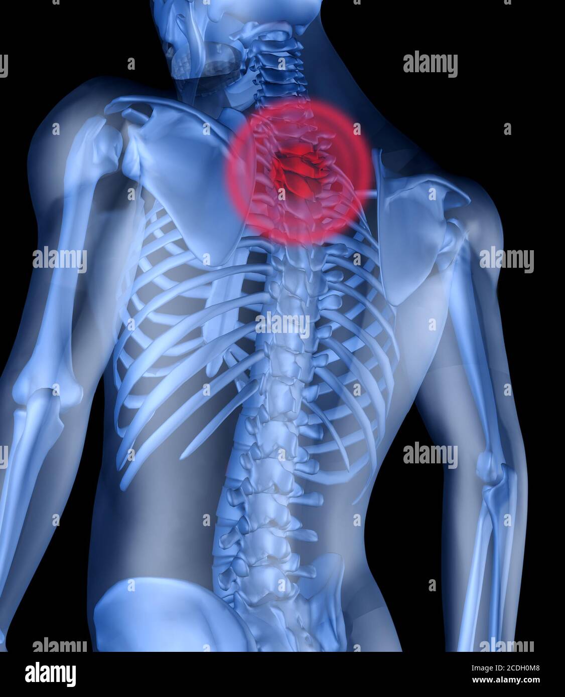 Skeleton of the man with the centres of a pain of a backbone Stock ...