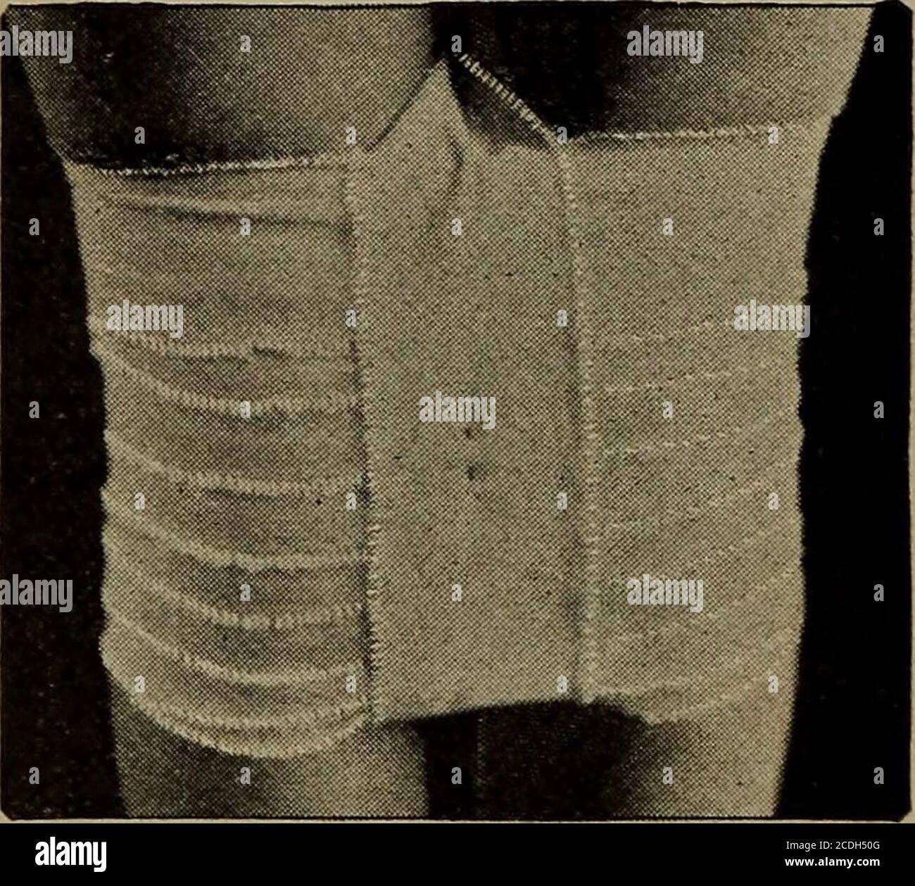 . Minor surgery and bandaging, including the treatment of fractures and ...