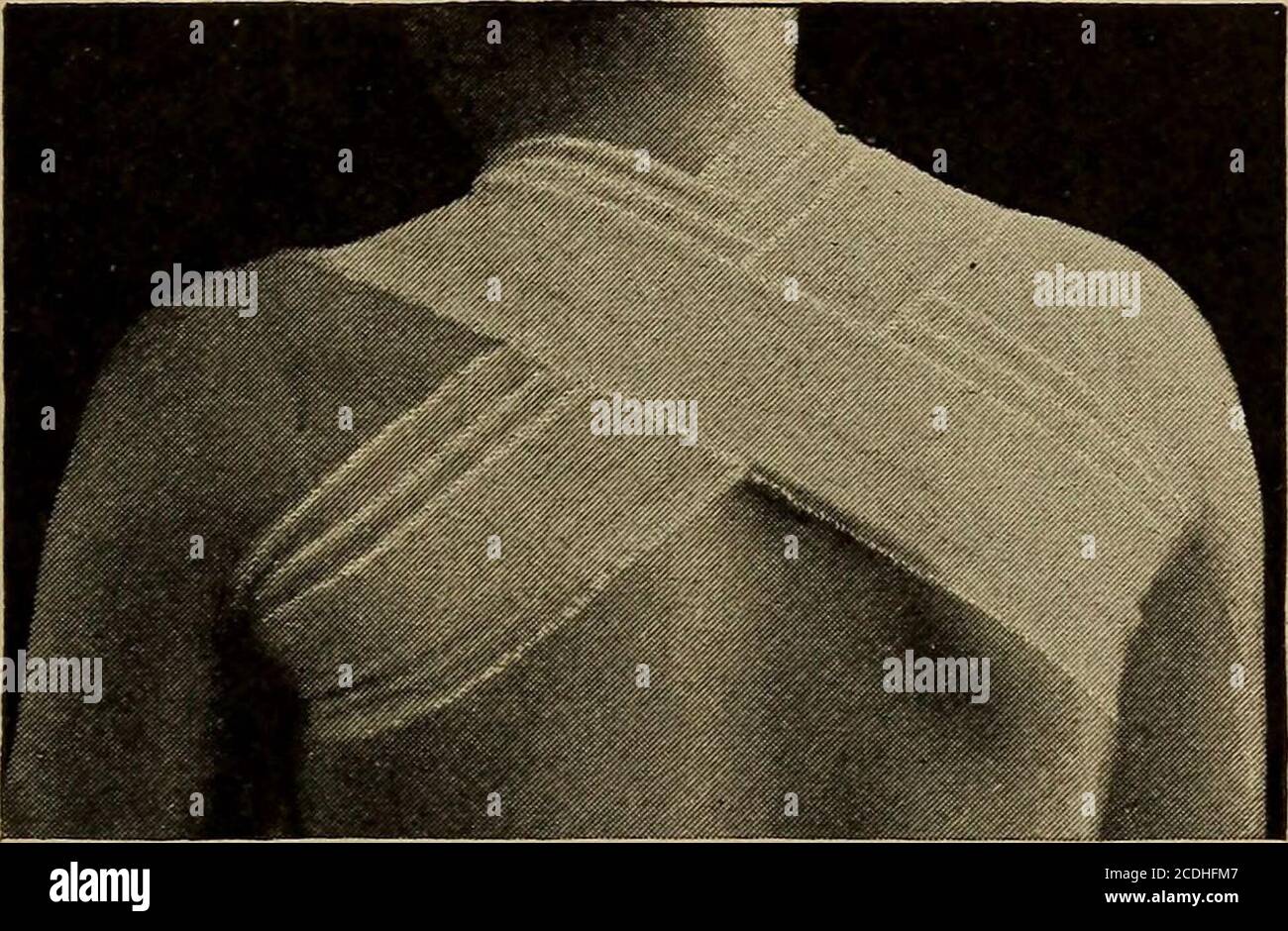 . Minor surgery and bandaging, including the treatment of fractures and ...