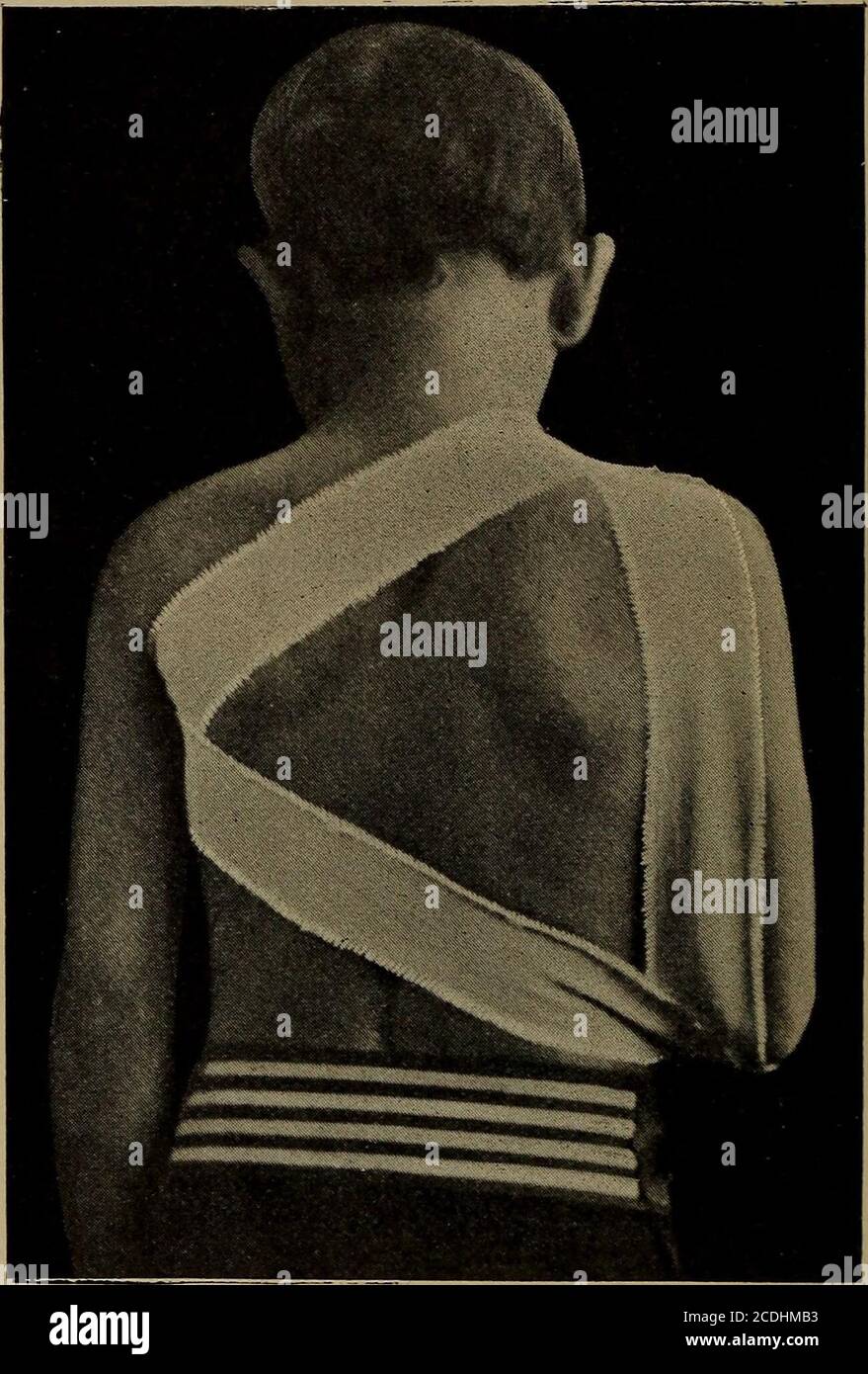 . Minor surgery and bandaging, including the treatment of fractures and ...