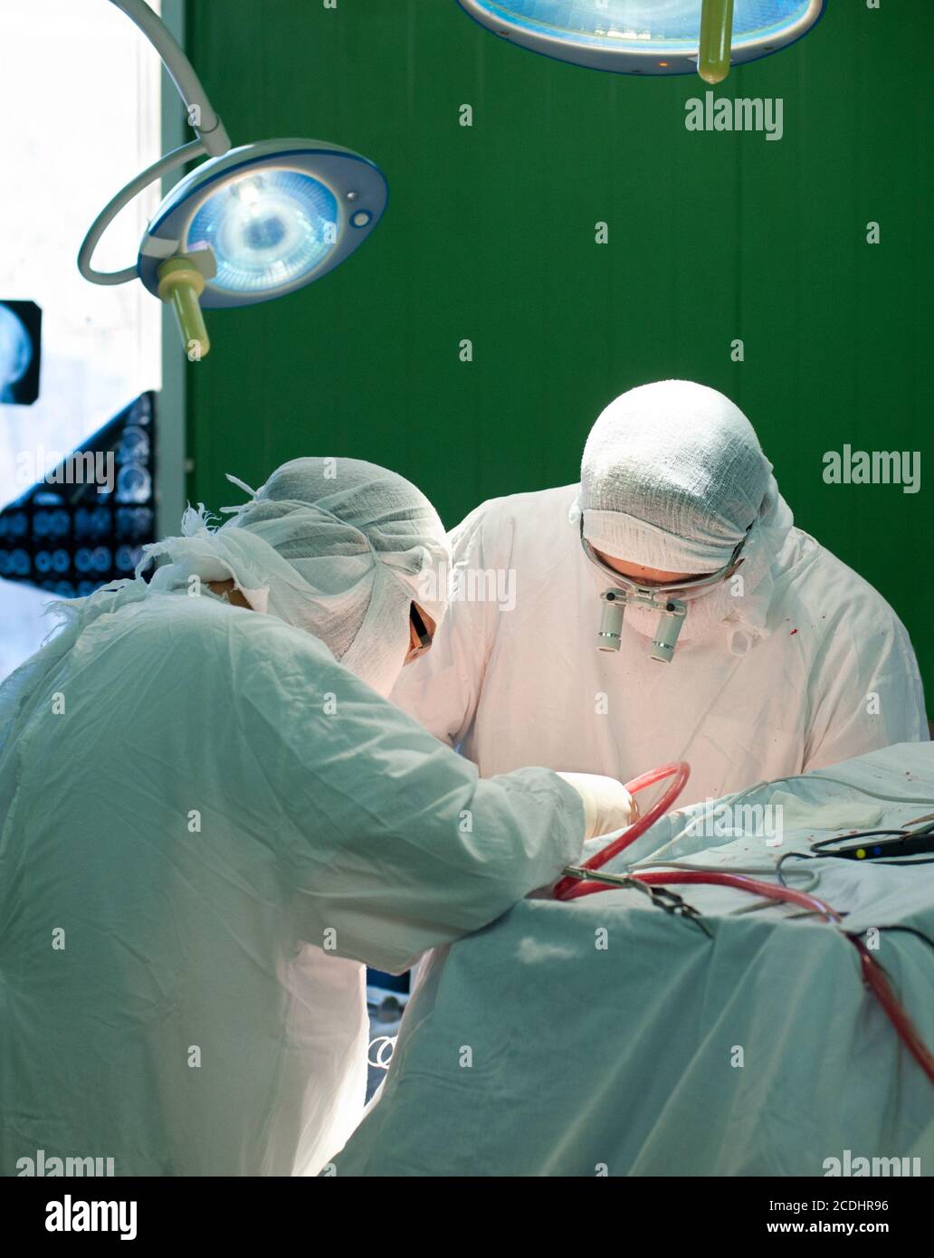 real brain surgery Stock Photo - Alamy