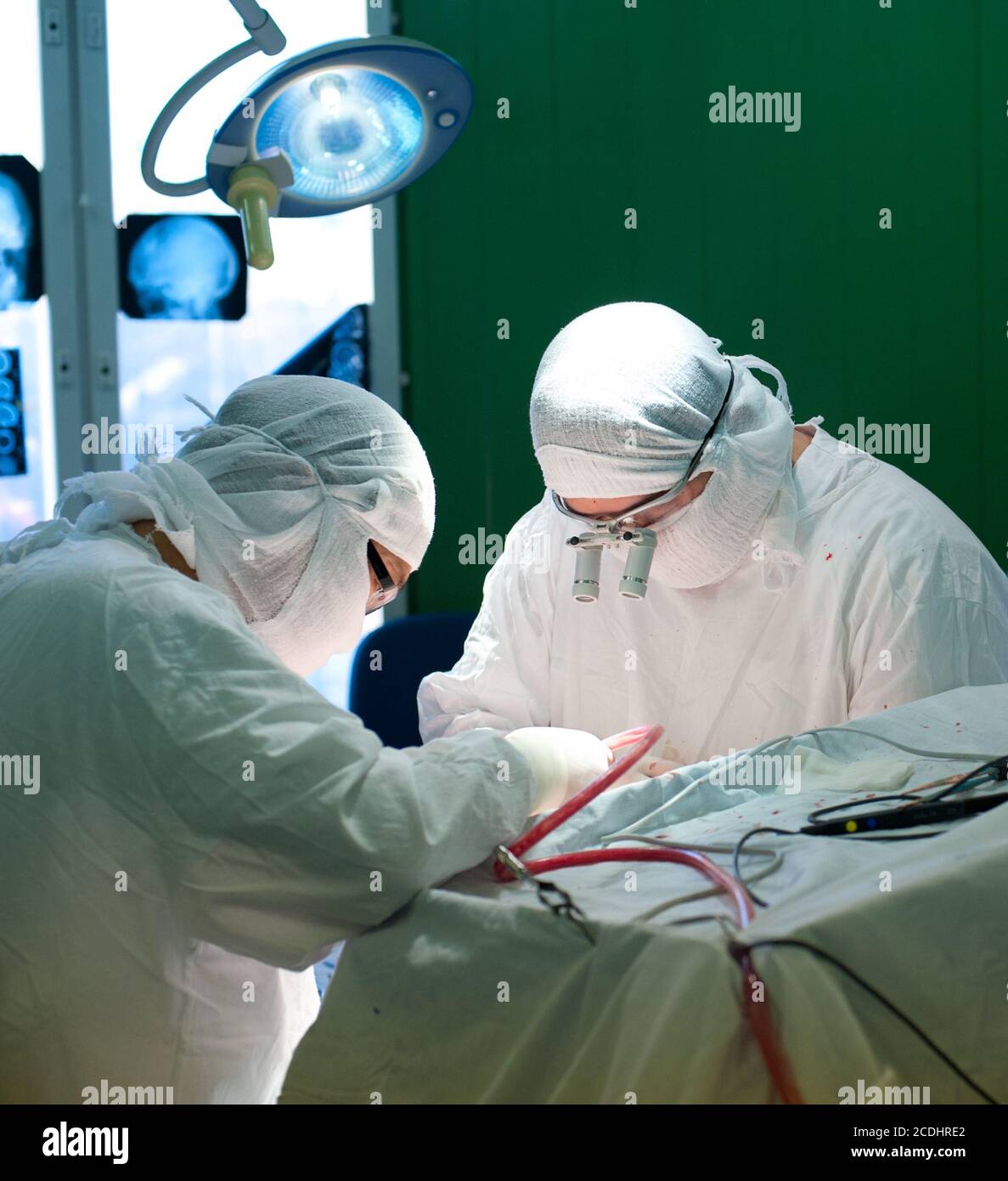 Real brain hi-res stock photography and images - Alamy