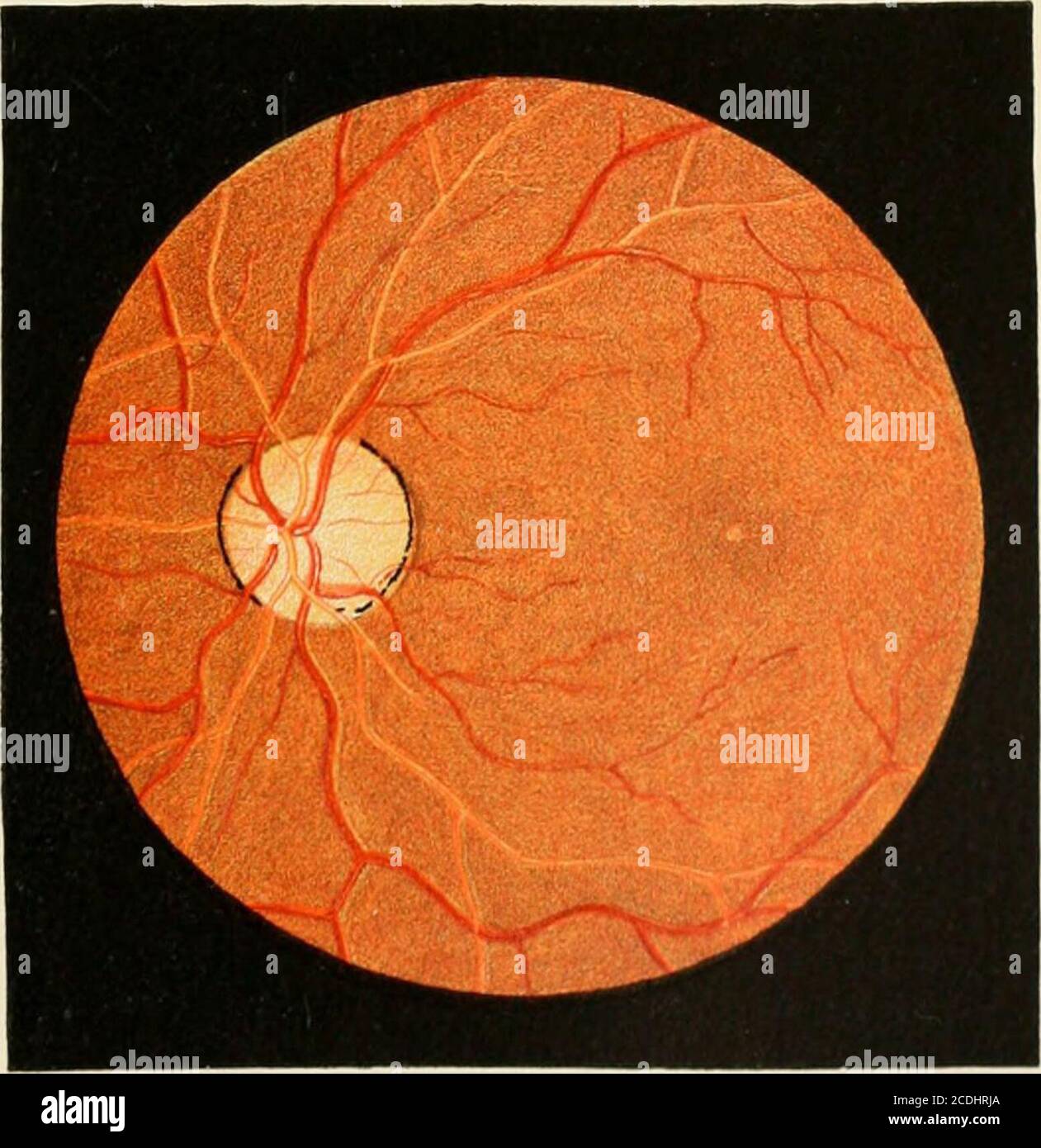 Dioptres hi-res stock photography and images - Alamy