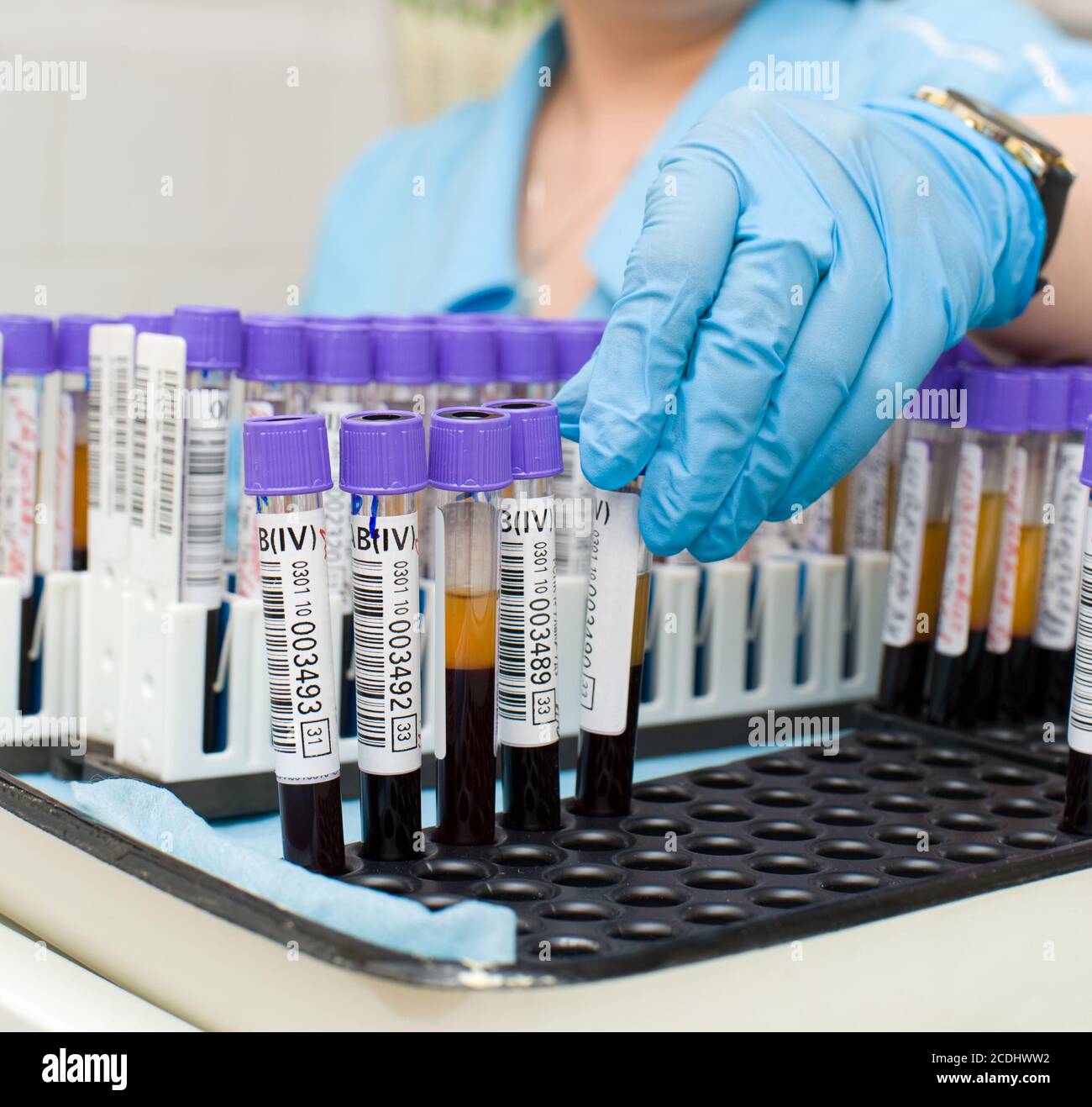 test tubes with blood Stock Photo - Alamy