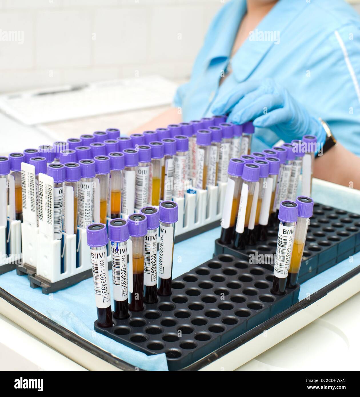 test tubes with blood Stock Photo - Alamy