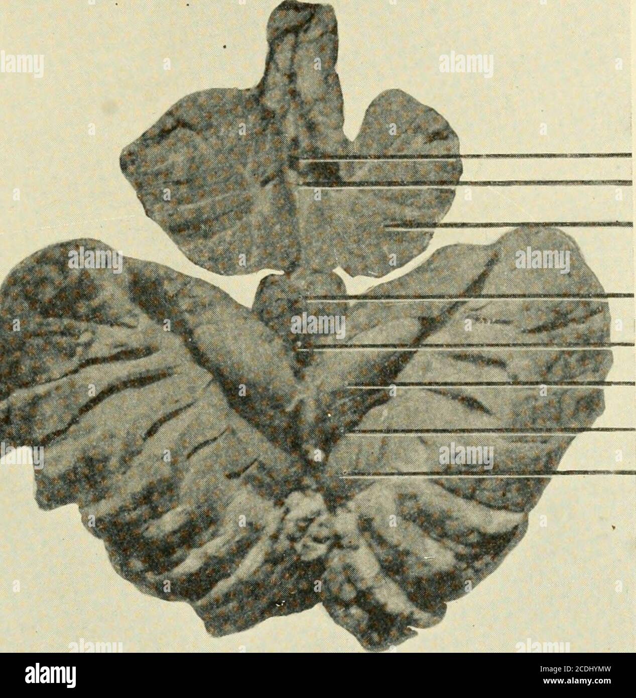 Corpus Callosum Hemisphere High Resolution Stock Photography and Images ...