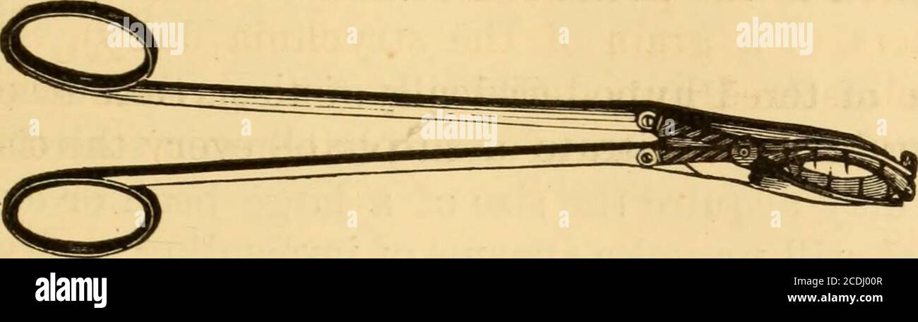 Uvula drawing hi-res stock photography and images - Alamy