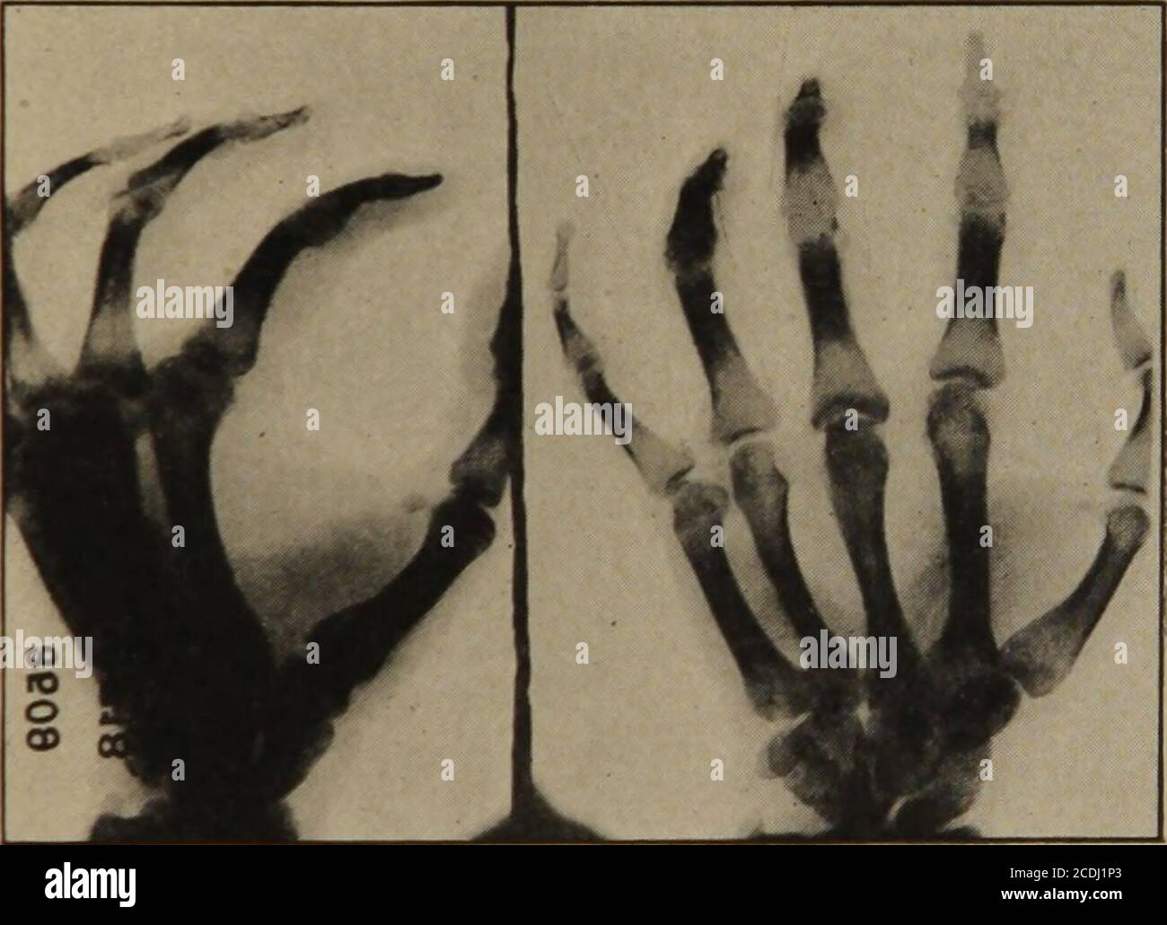 Movementsideways hi-res stock photography and images - Alamy