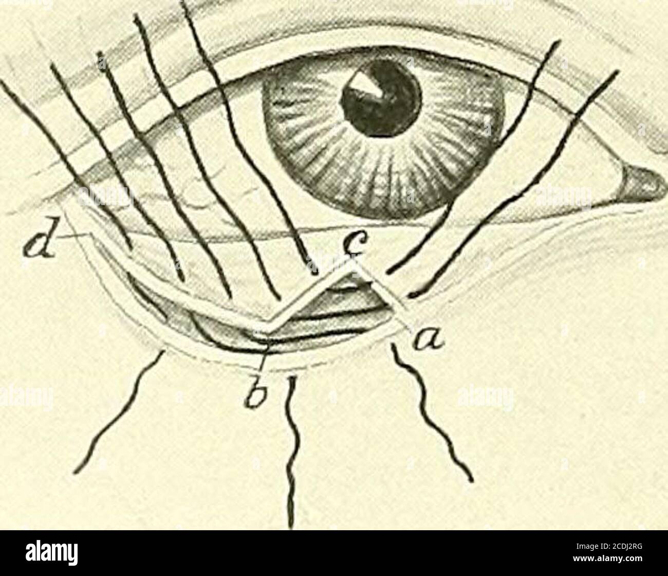 Diagrama De Fissura Palpebral Dysmorphology Of The Eye And Periorbital
