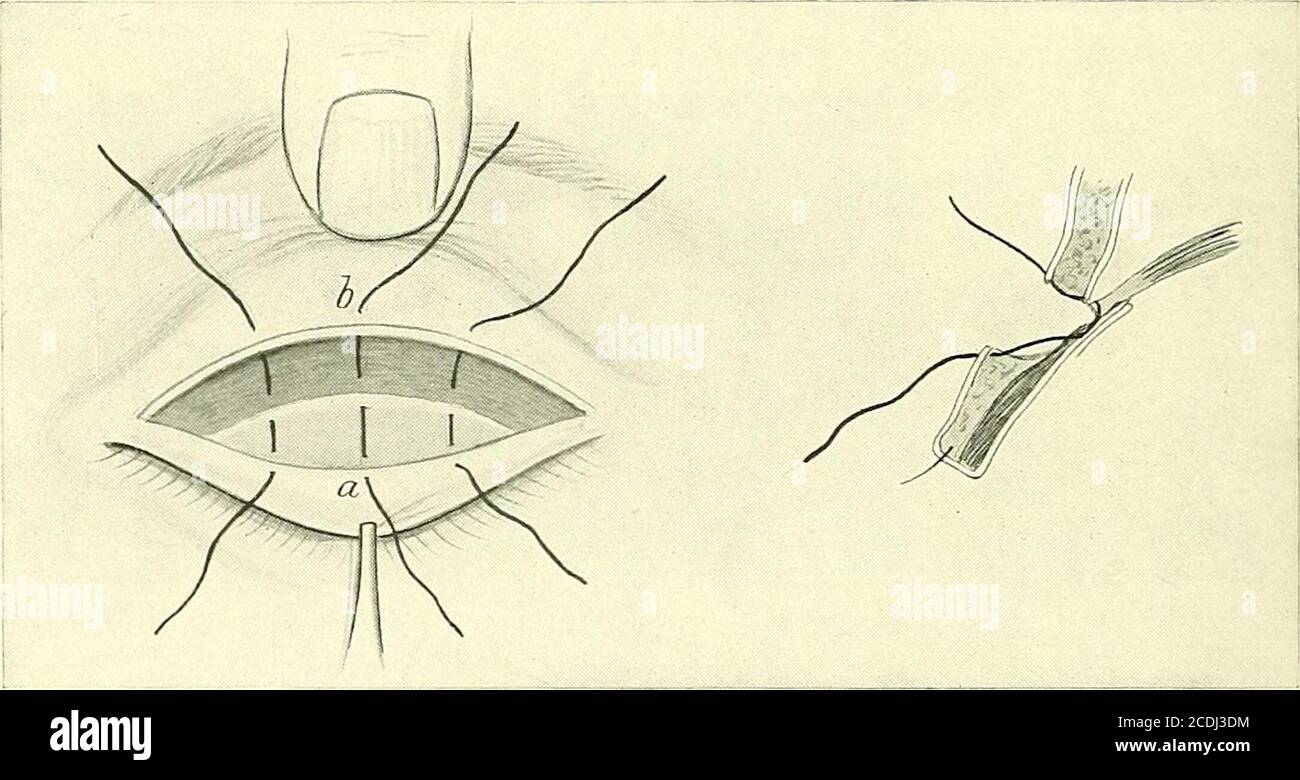 . Surgery, its principles and practice . rds and illustrated with his ...