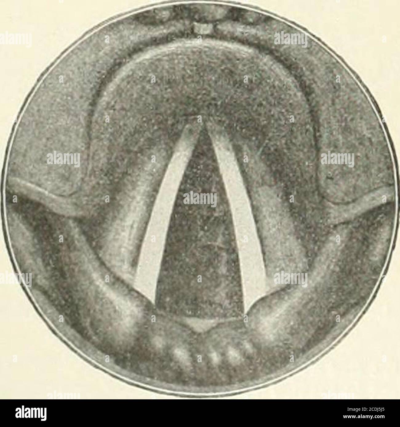 . A Reference handbook of the medical sciences embracing the entire ...