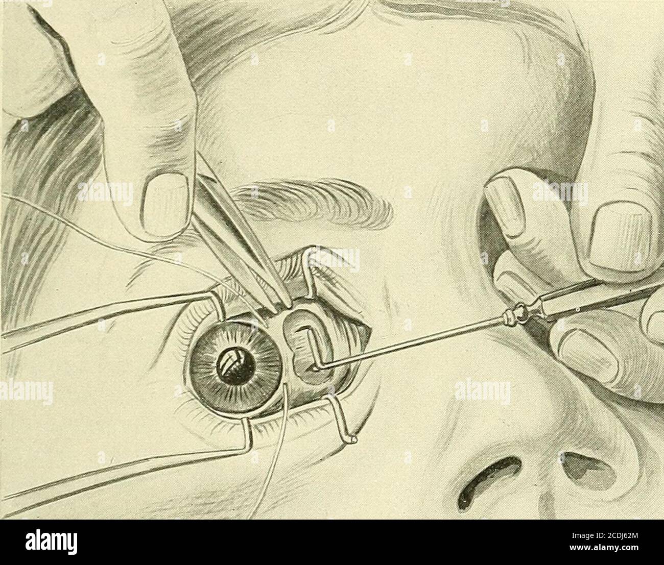 Conjunctival sac hi-res stock photography and images - Alamy
