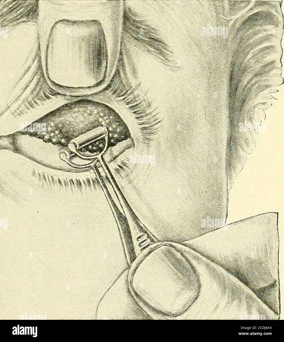 . Surgery, its principles and practice . s operation),and squeezing or ...