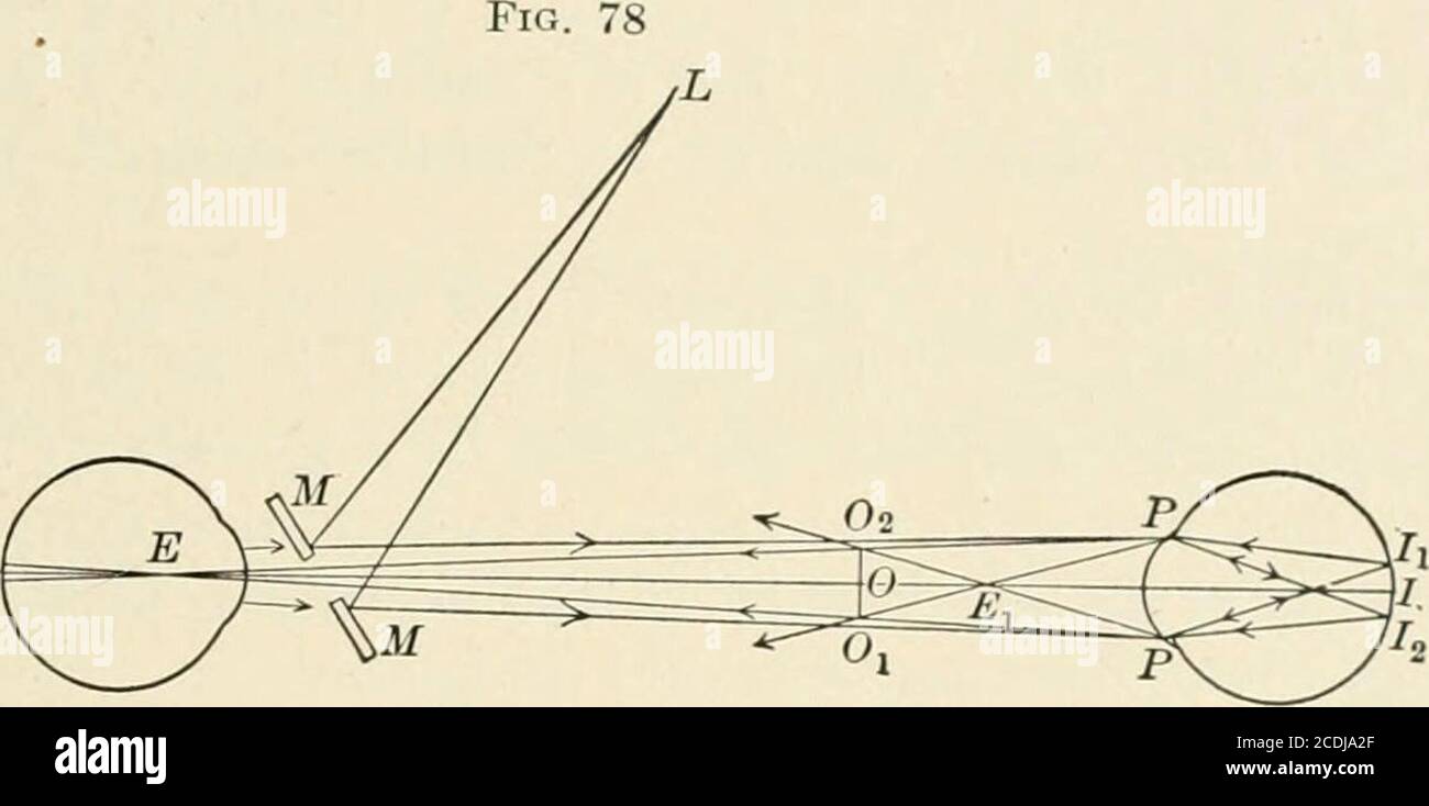 Inverted reflex hi-res stock photography and images - Alamy