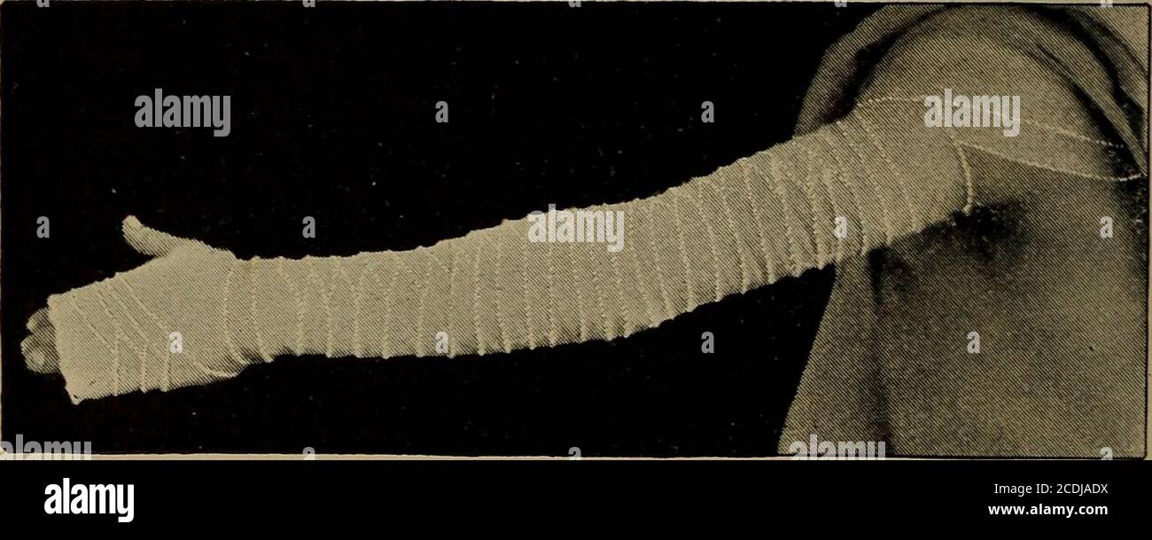 . Minor surgery and bandaging, including the treatment of fractures and ...