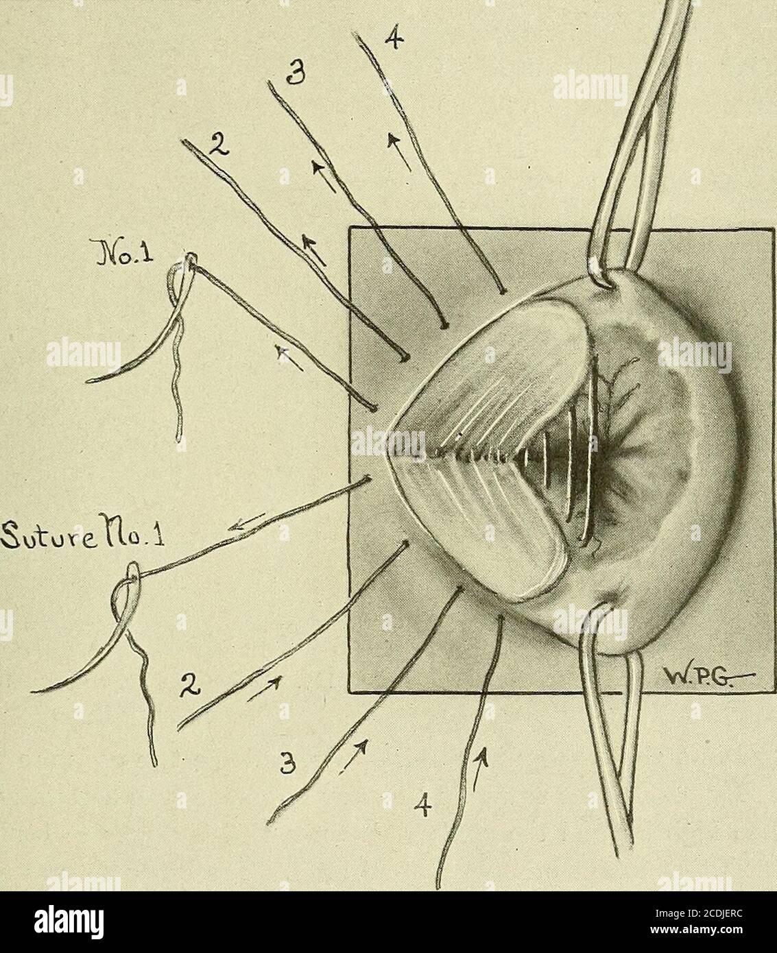 . Gynecology : . on theside of getting it too wide than too narrow ...