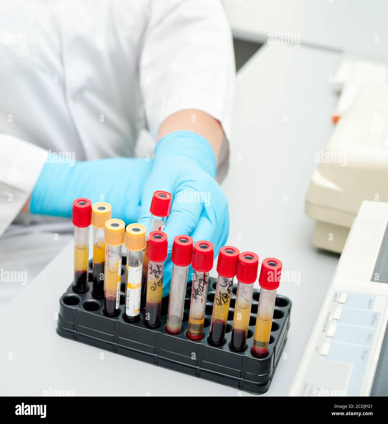 Blood group test hi-res stock photography and images - Alamy