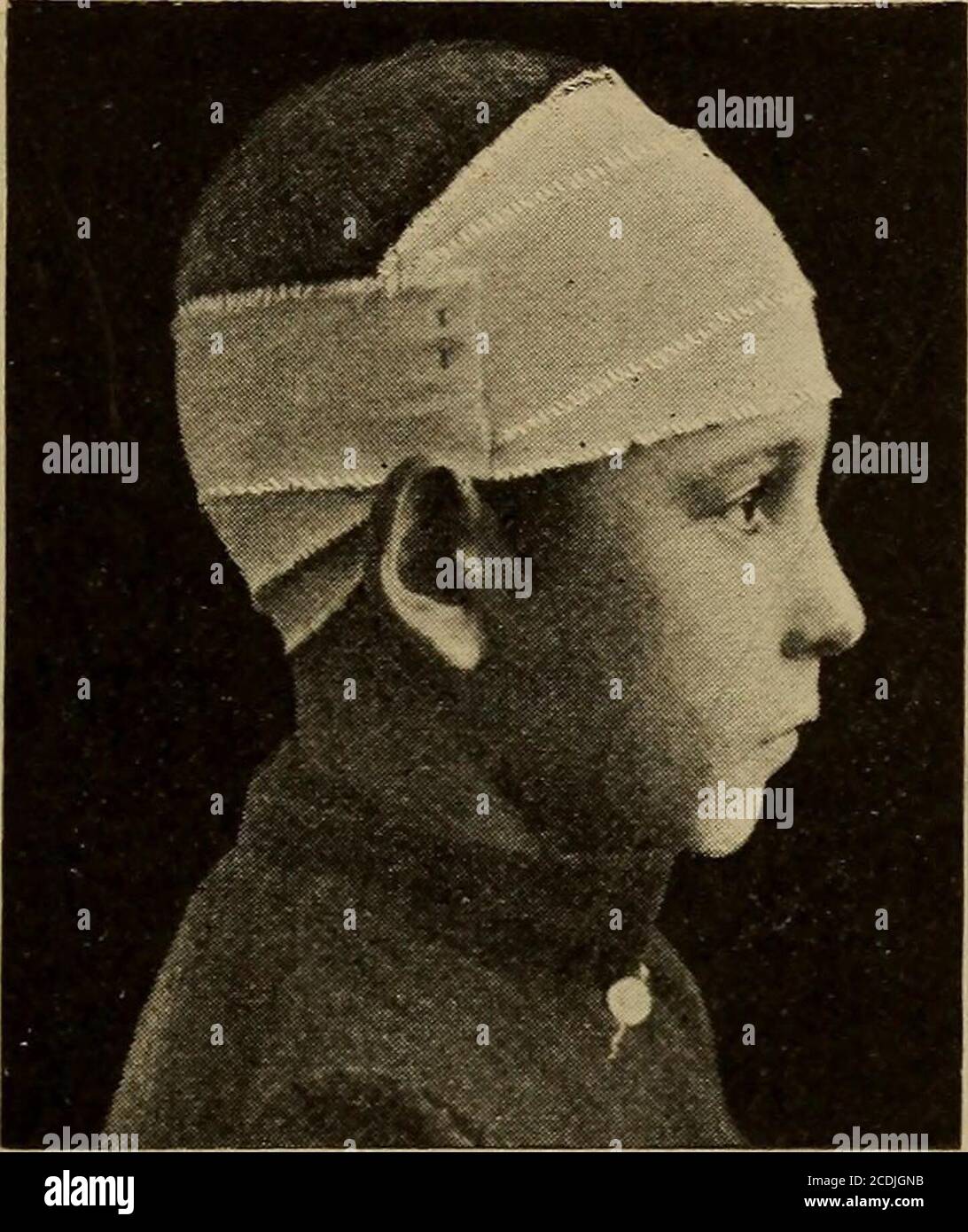 . Minor surgery and bandaging, including the treatment of fractures and ...