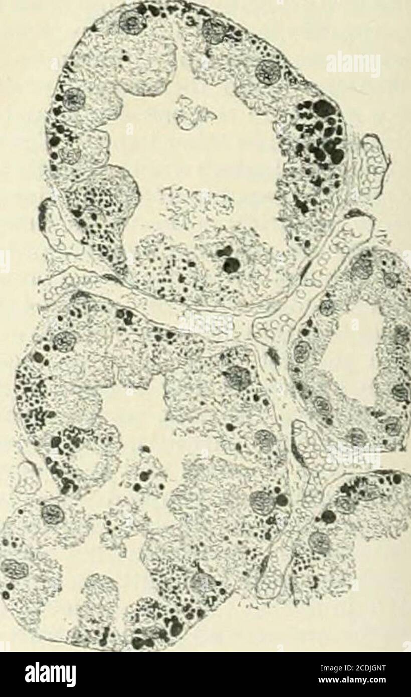 Plasmacells hi-res stock photography and images - Alamy