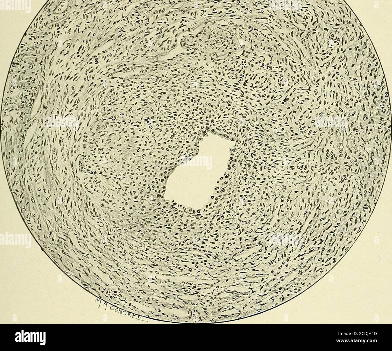 . Gynecology : . NITAL ATROPHY The clinical importance of the ...