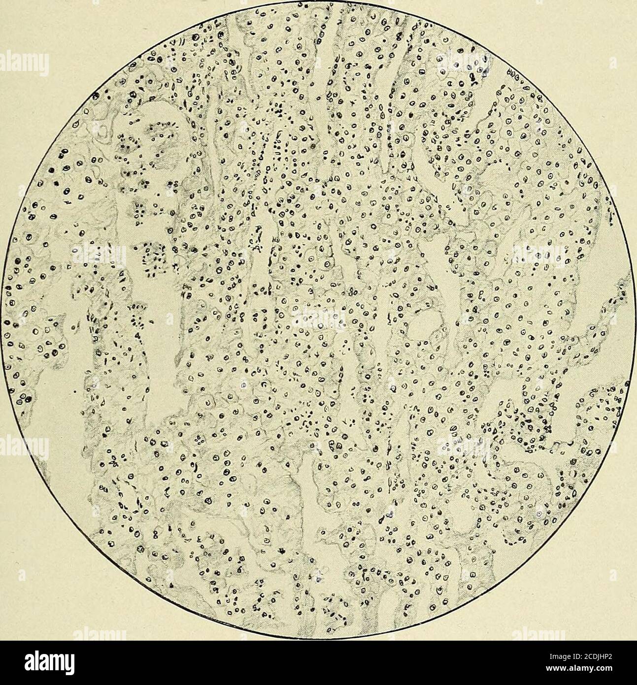 . Gynecology : . ge from the ostium of thetube, the patient may bleed ...