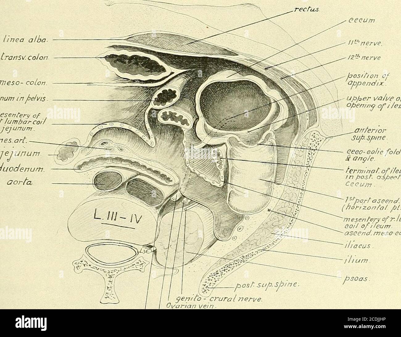 Ileocecal hi-res stock photography and images - Alamy