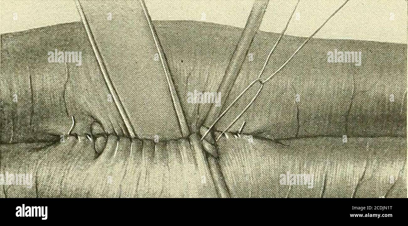 Stitch principles hi-res stock photography and images - Alamy