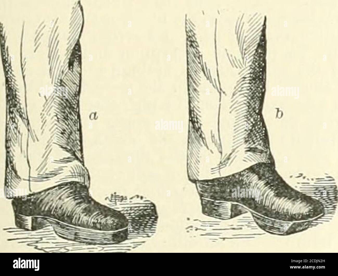 Compression lighter hi-res stock photography and images - Alamy