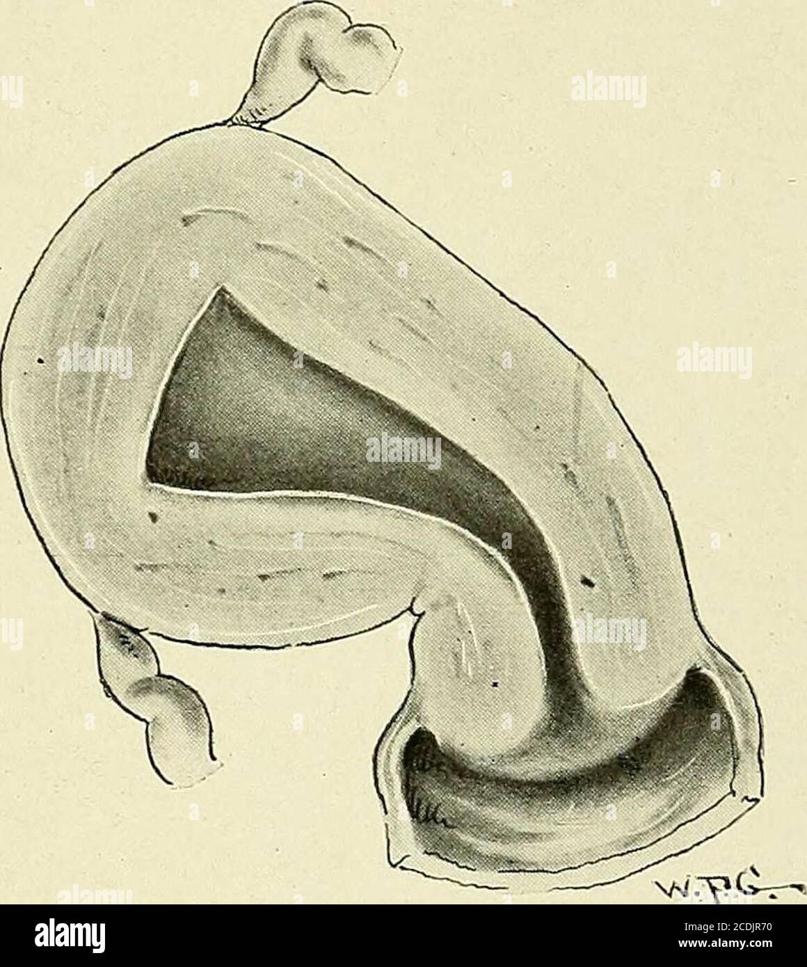 . Gynecology : . Fig. 189.—Lateral Version.. Fig. 190.—Lateral Flexion ...