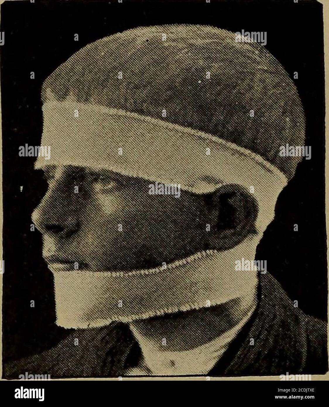 . Minor surgery and bandaging, including the treatment of fractures and ...