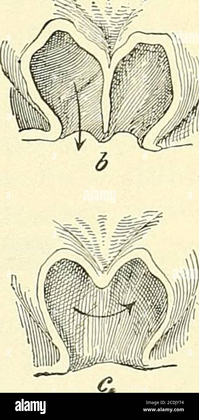 . Surgery, its principles and practice . Fig. 376.—Treatment of ...