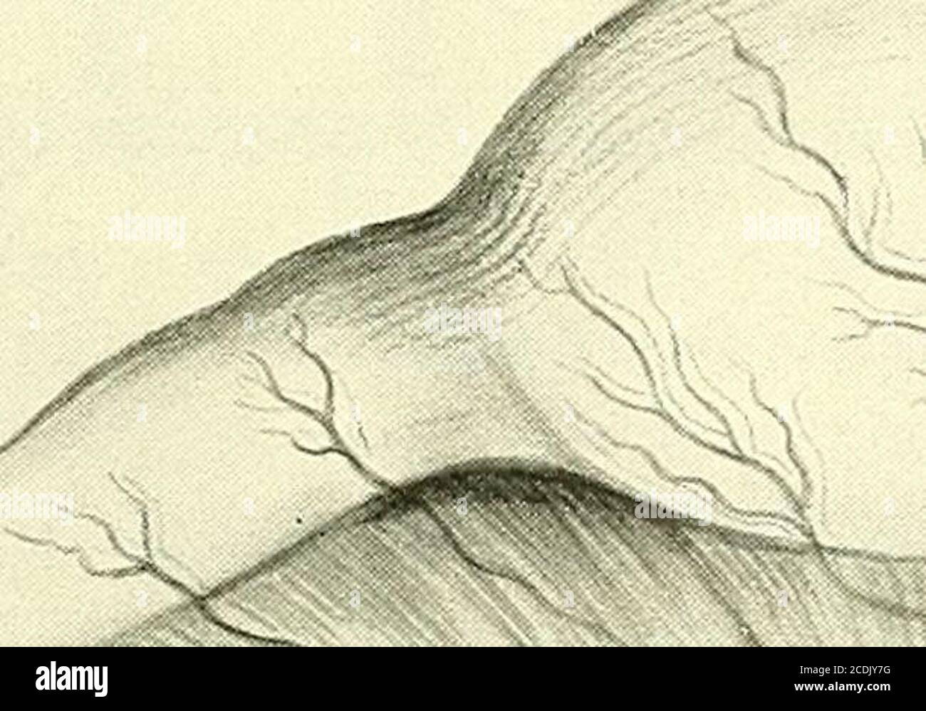 . Surgery, its principles and practice . Fig. 376.—Treatment of ...