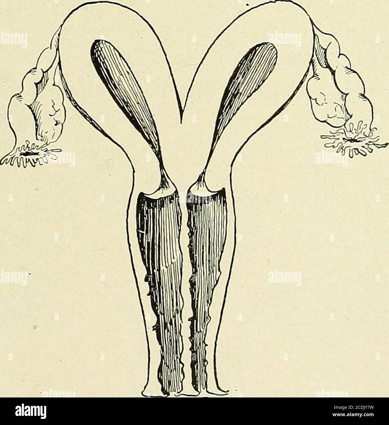 . Gynecology : . eing consummated after maturity,due possibly to the ...